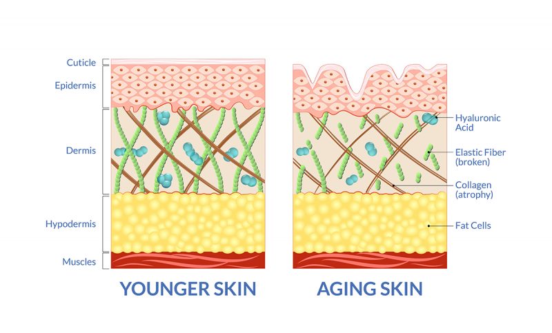 Introlift Best Treatments For Skin Tightening Introlift Medical Spa